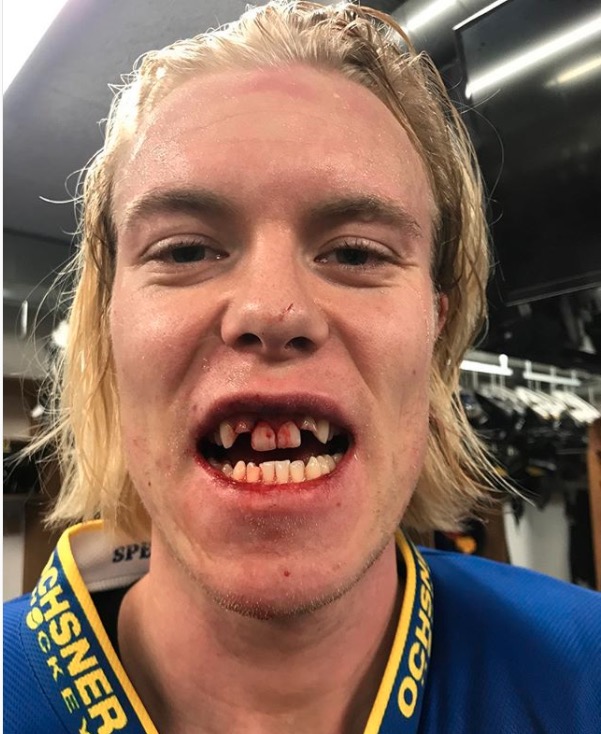 SwissHabs | Le nouveau sourire de Sam Lofquist